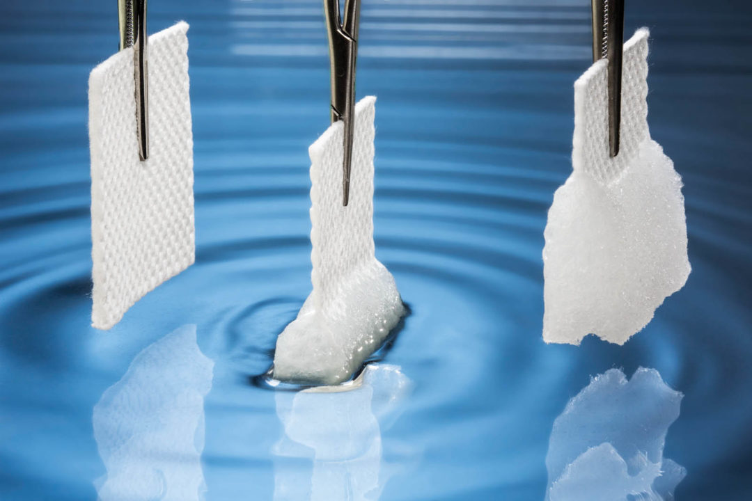 Superabsorbent wound dressing - Specialty Fabrics Review